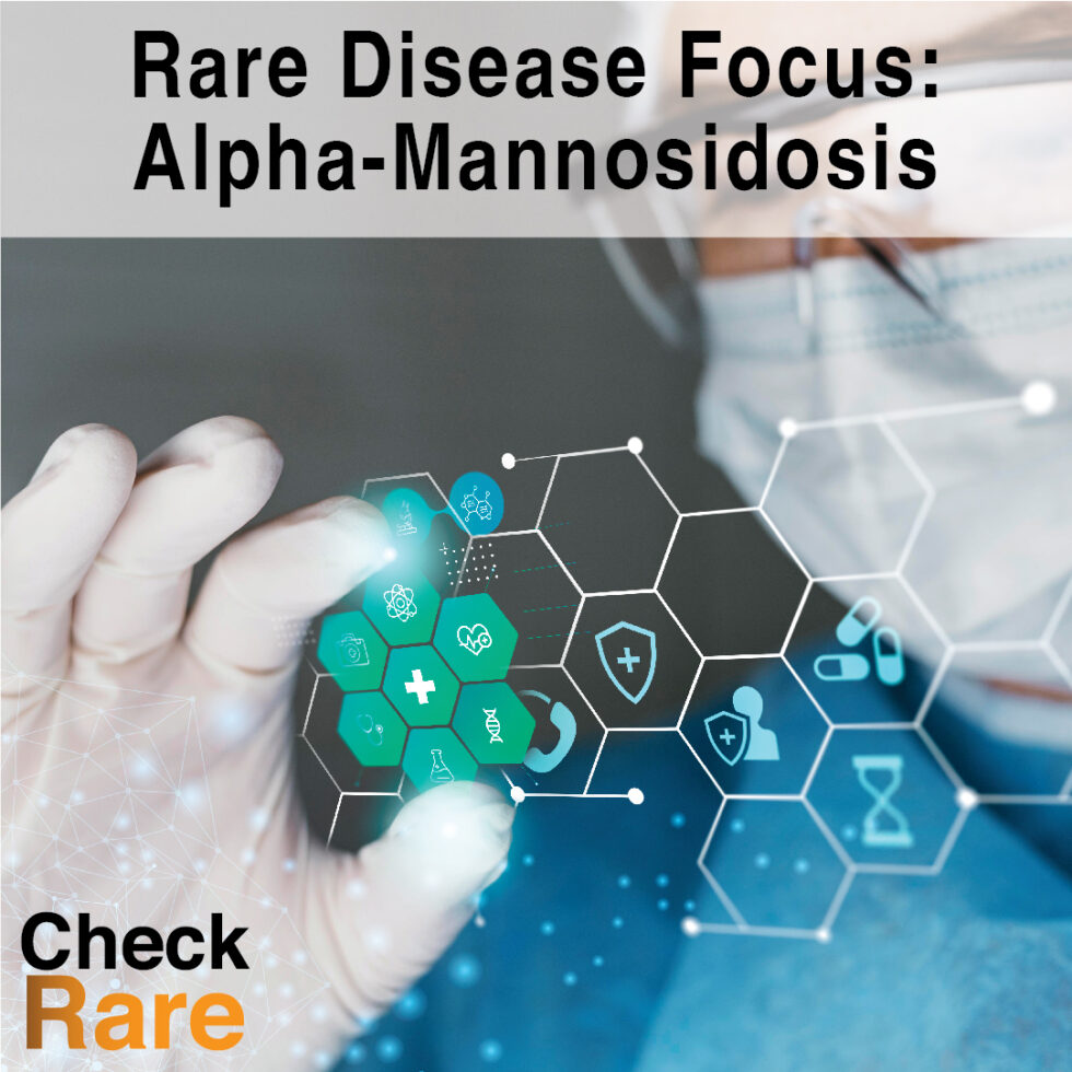 Alpha-Mannosidosis: Disease Overview, Signs and Symptoms, Emerging ...