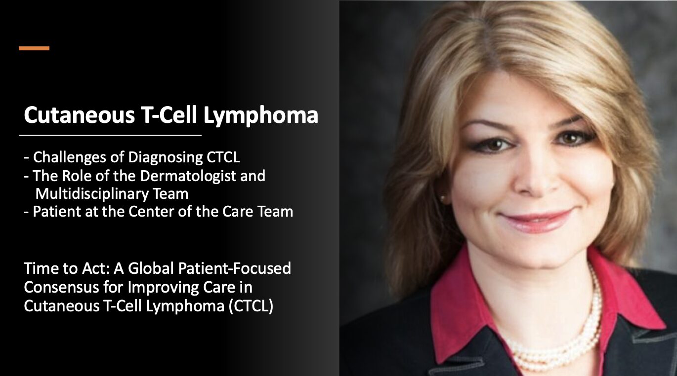CTCL: The Role of Dermatologists in Diagnosing and Caring for Patients ...